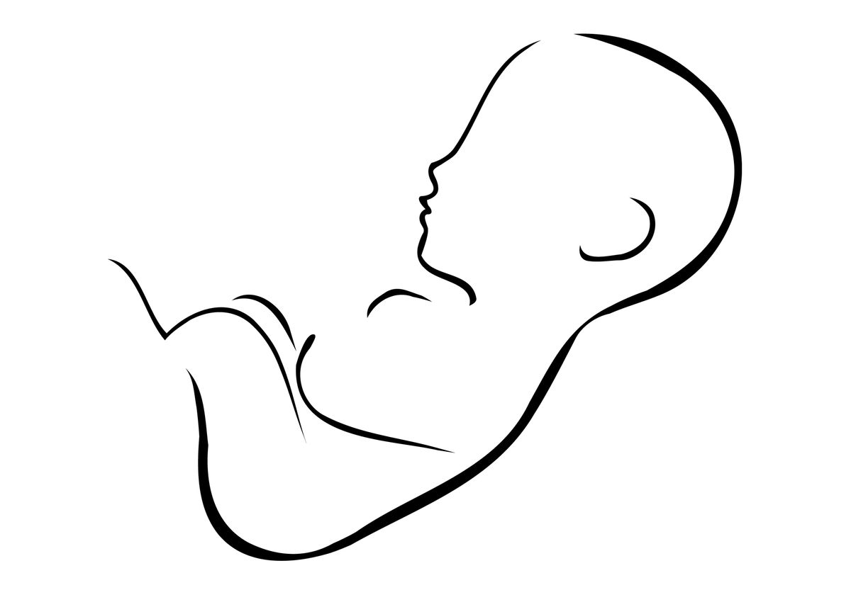'Abstract Drawing of fetus' Poster, picture, metal print, paint by ...