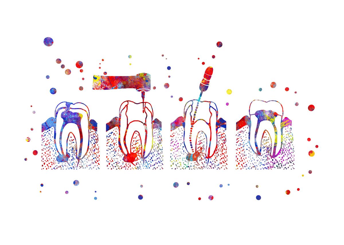'The root canal therapy ' Poster, picture, metal print, paint by ...