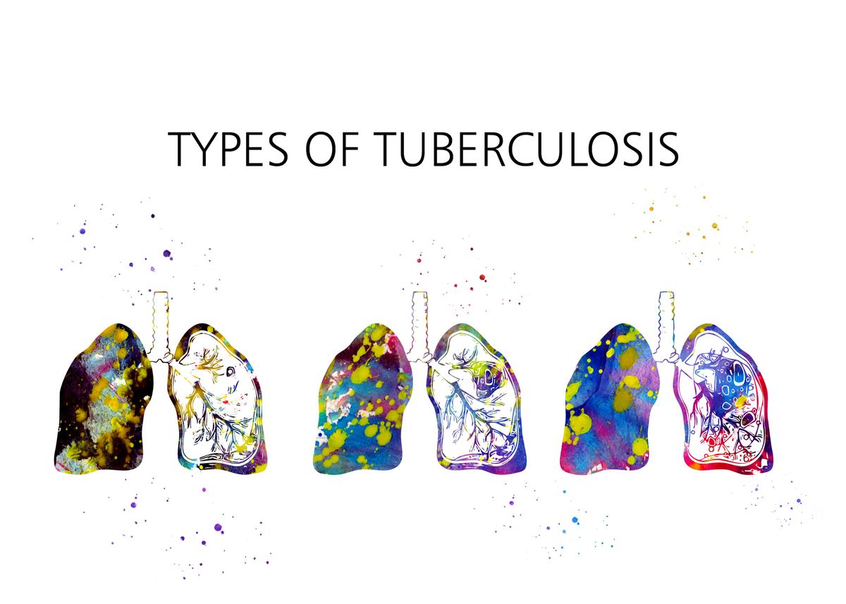 'Tuberculosis Types ' Poster, picture, metal print, paint by Erzebet ...