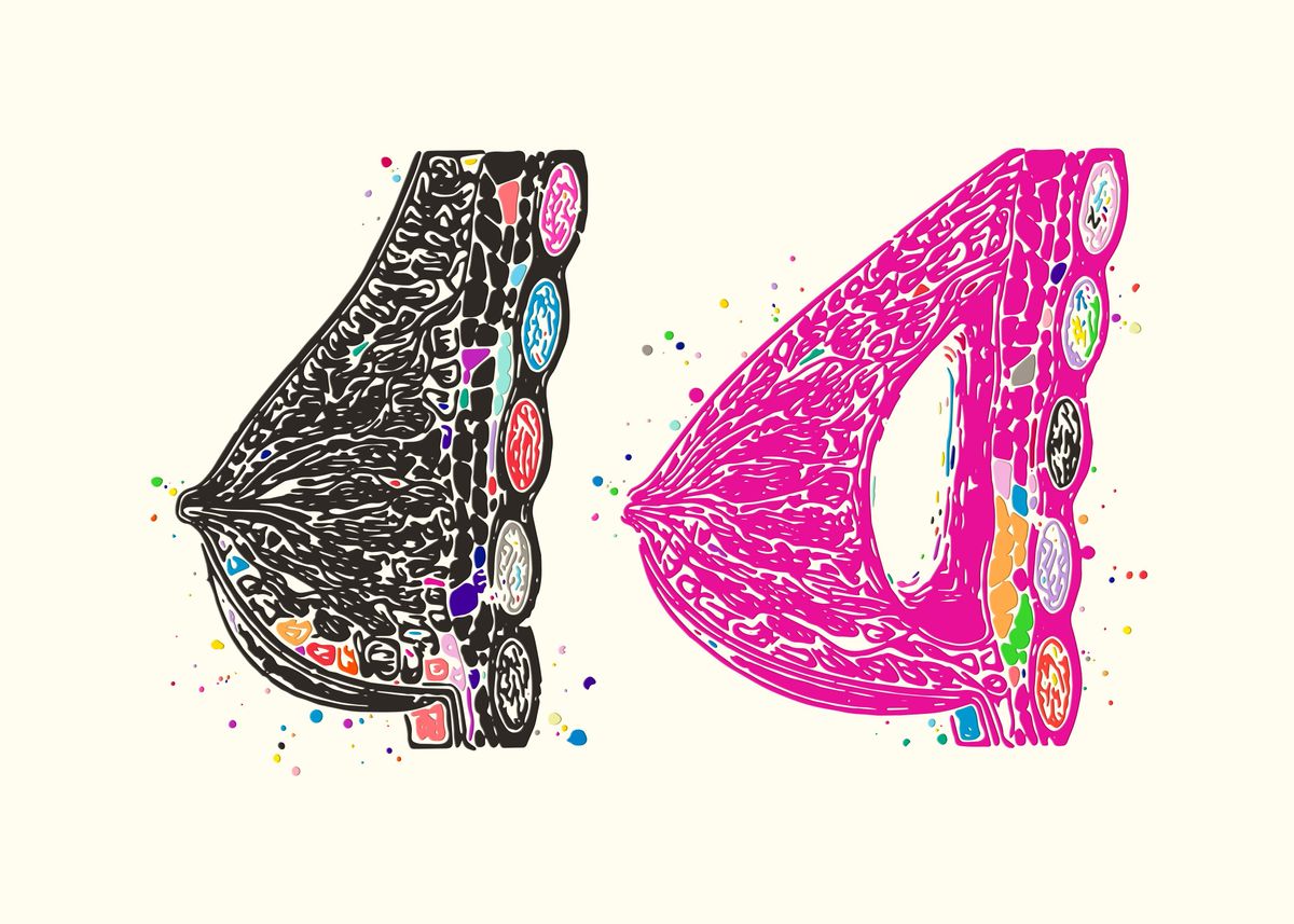 'Breast Implant' Poster, picture, metal print, paint by Dutton Jerrell | Displate