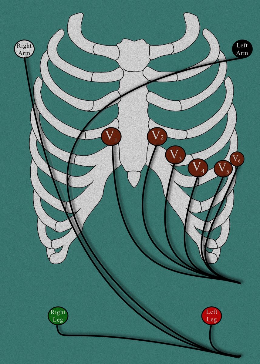 '12-Lead EKG poster' Poster, picture, metal print, paint by Kyle ...
