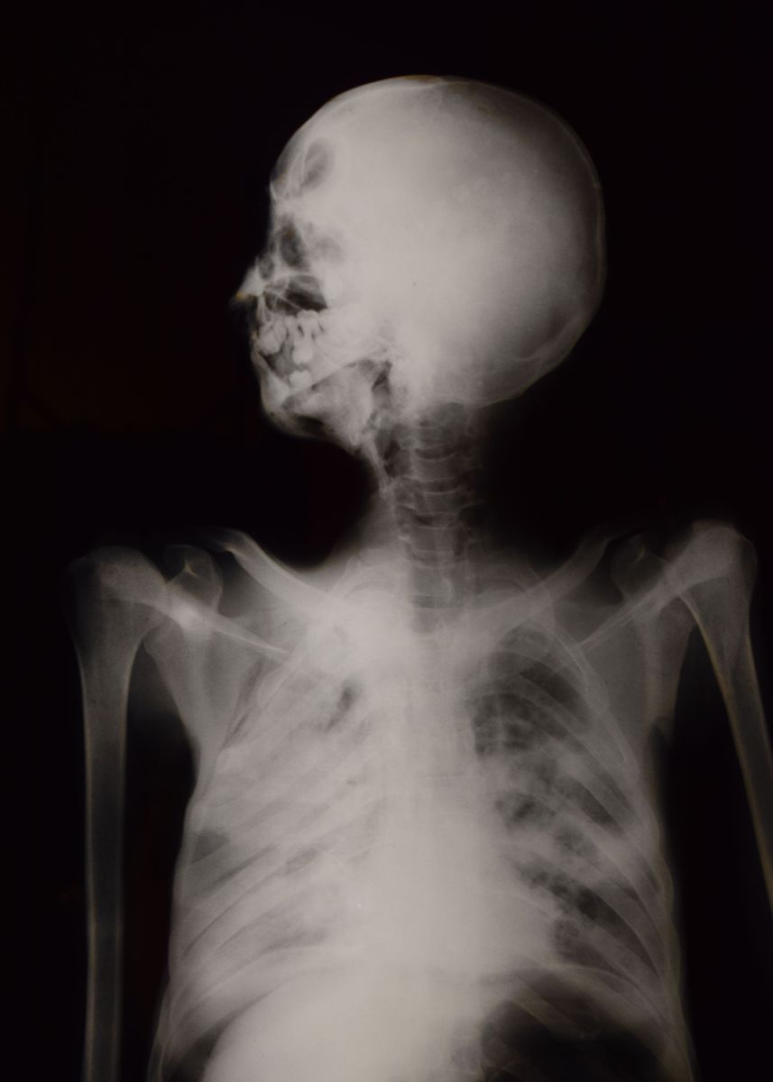 'Human roentgenogram' Poster, picture, metal print, paint by Anton Eine ...