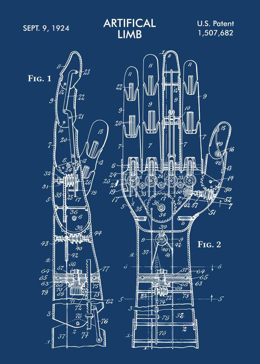 'ARTIFICAL LIMB BLUEPRINT' Poster, picture, metal print, paint by ...