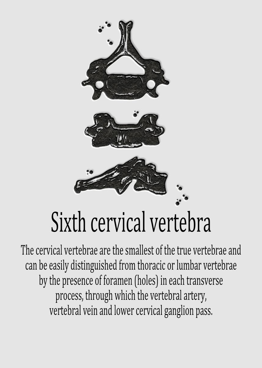 'Sixth cervical vertebra' Poster by Clayborne Frank | Displate