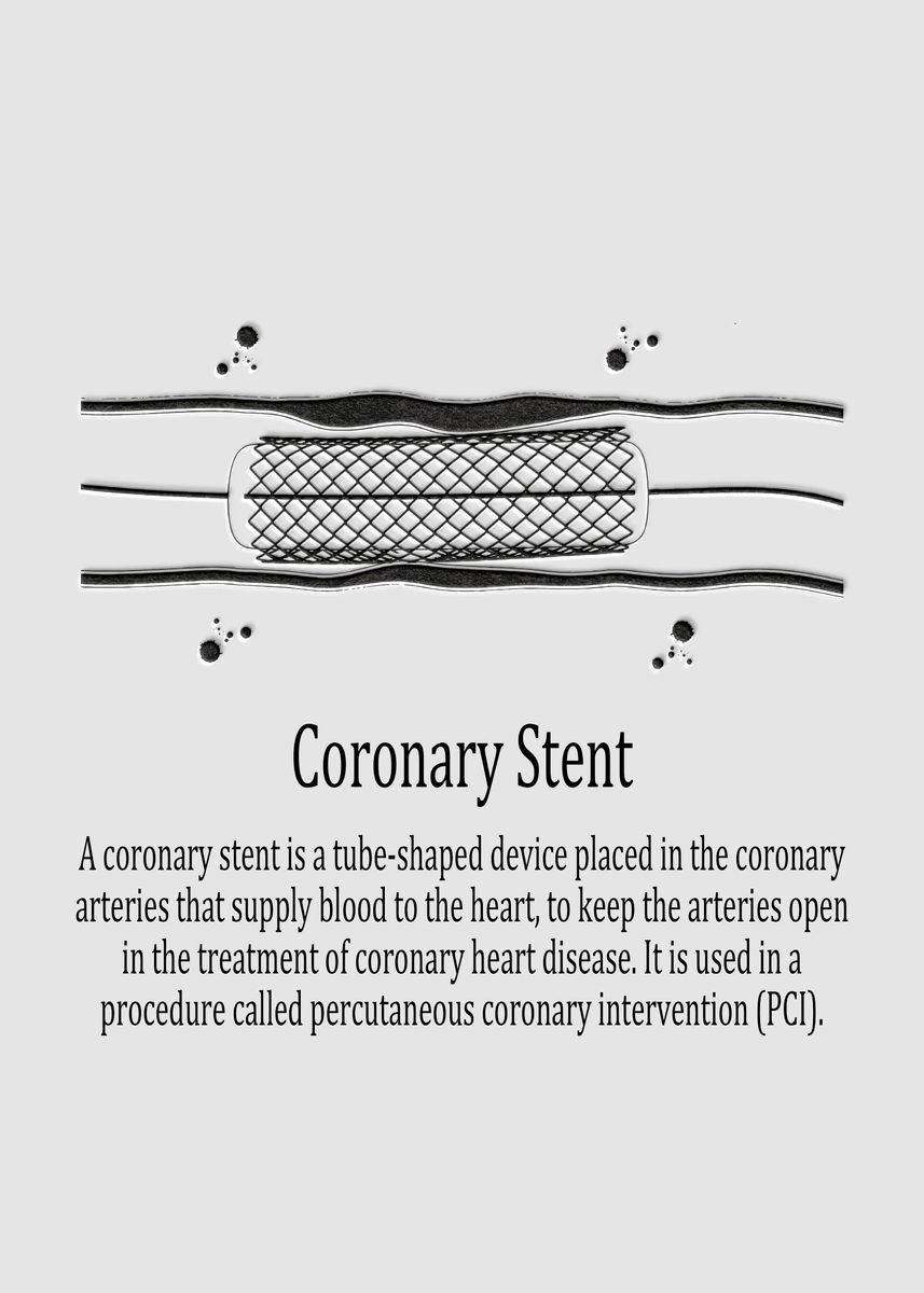 'Coronary Stent' Poster, picture, metal print, paint by Clayborne Frank ...