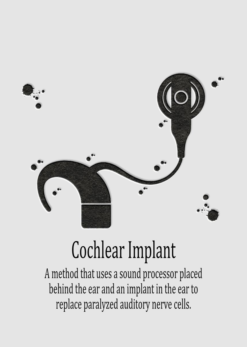 'Cochlear Implant' Poster, picture, metal print, paint by Clayborne ...