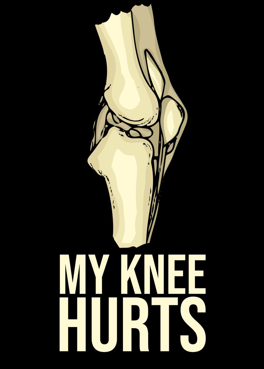 'Knee Replacement Recovery ' Poster, picture, metal print, paint by ...