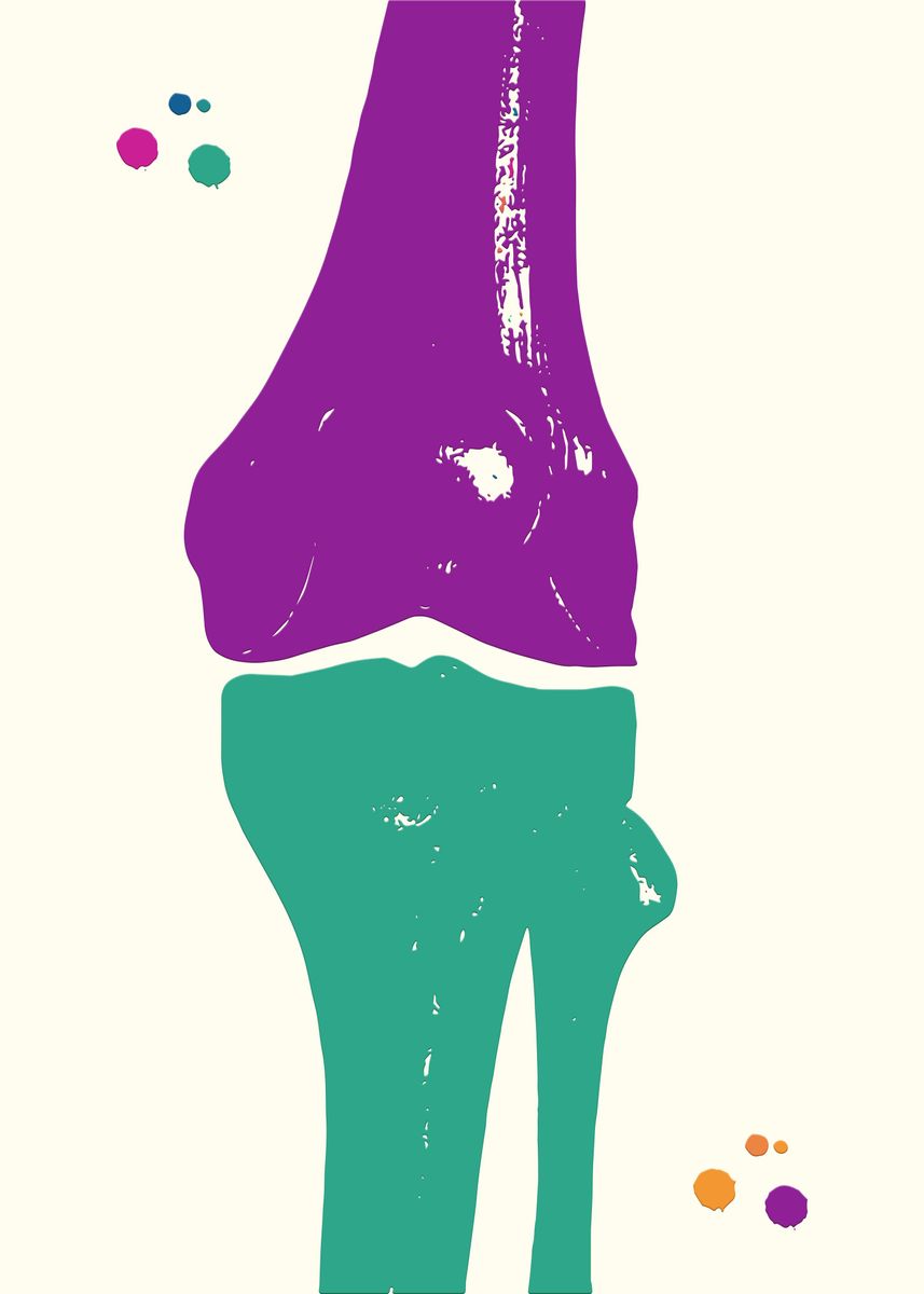 'Medical Painting Knee Bone' Poster, picture, metal print, paint by Dutton Jerrell | Displate