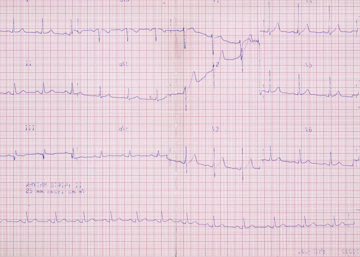 'ECG real chart' Poster by Gianfranco Grenar | Displate