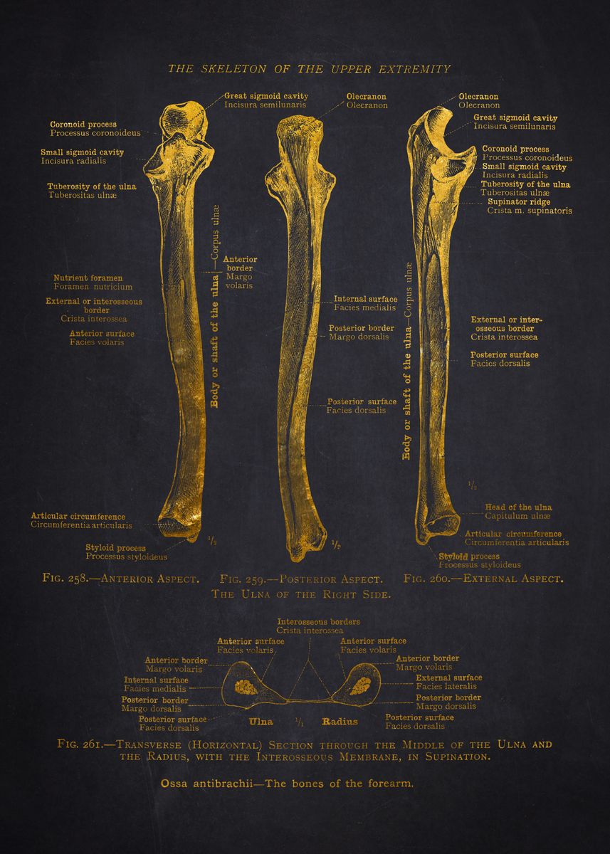 'Ulna Bone Anatomy Diagram' Poster, picture, metal print, paint by Aged ...